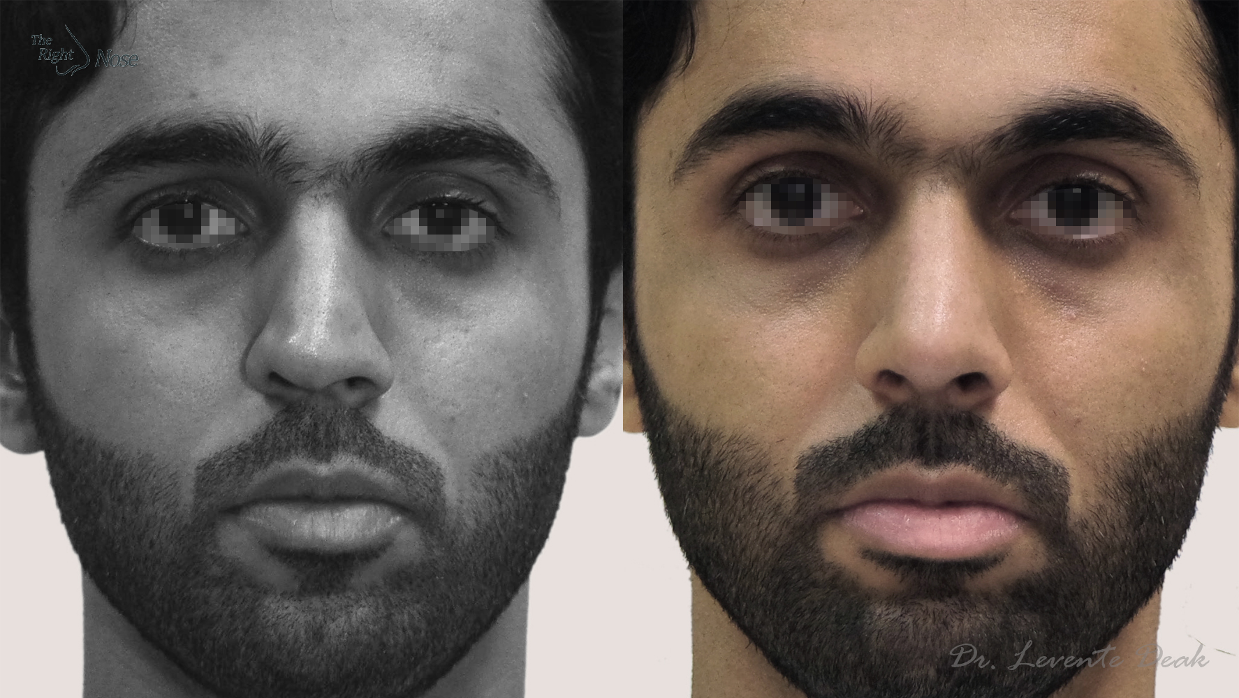 Male Tip - The Right Nose